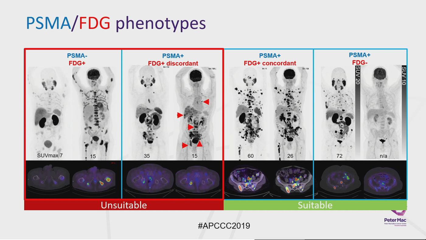 4人の患者さんの画像が示されています。1つの区画の左がPSMA PET/CT、右がFDG PET/CTです。